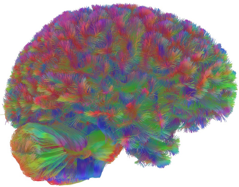 Five major “epochs” of human brain development – Dr Bob, Brain Mechanic